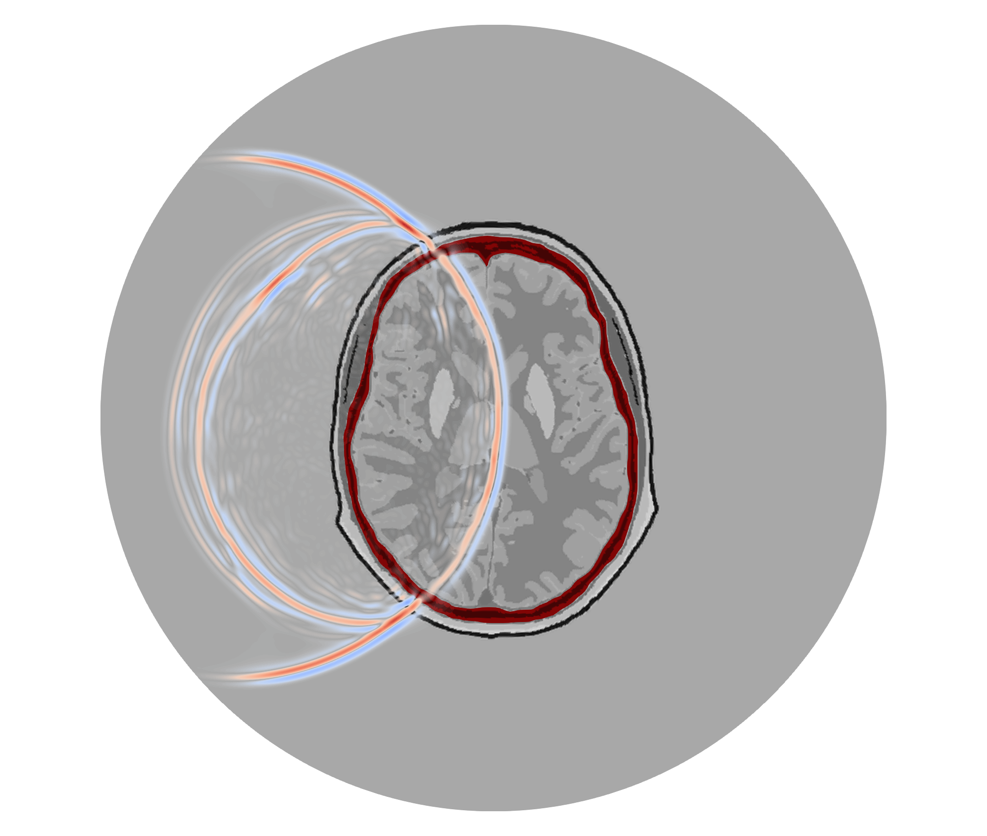 Transcranial Ultrasound Imaging - Pat Marty